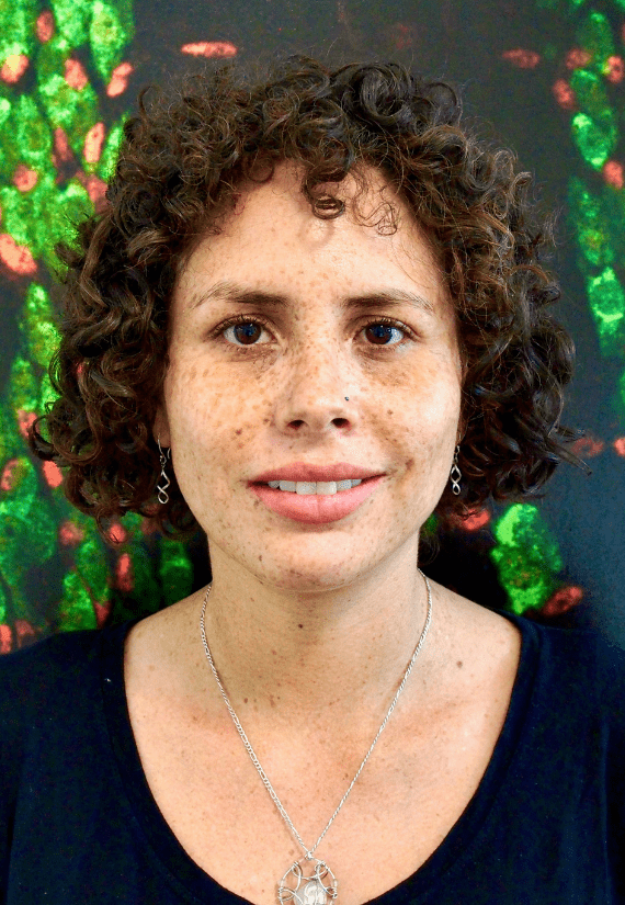 IASP Awards the John J. Bonica Trainee Fellowship to Paulina Ramirez ...
